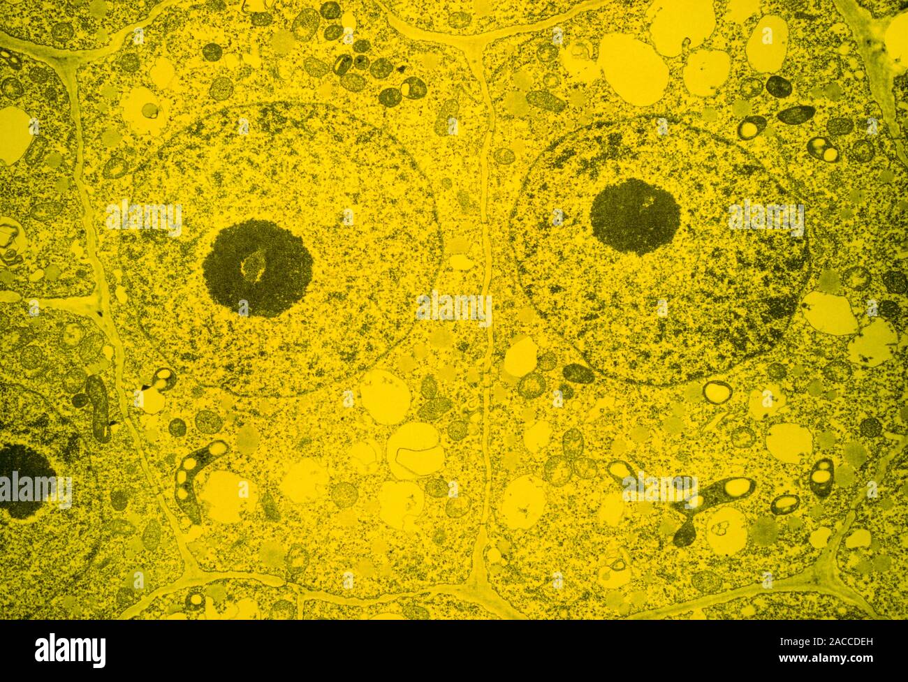 False-colour transmission electron micrograph (TEM) of cells in the ...