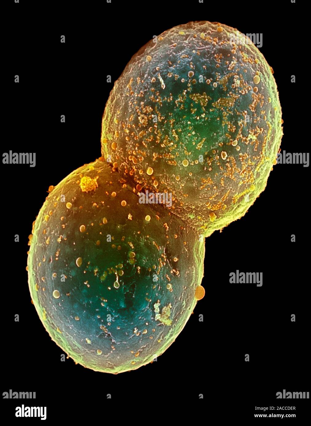 Protoplasts. Coloured scanning electron micrograph (SEM) of two tobacco ...