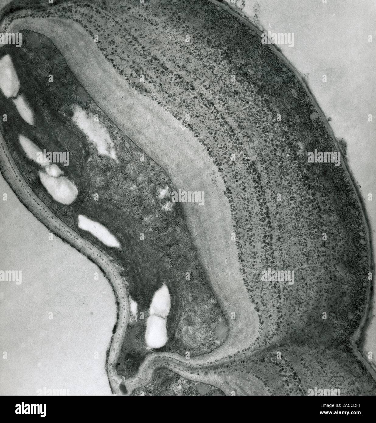 Leaf epidermal cell. Transmission electron micrograph (TEM) of a ...