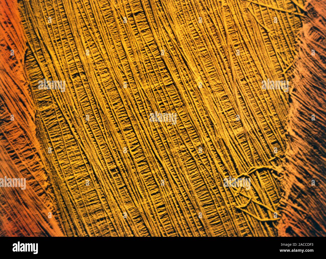 Algae cell wall. Coloured scanning electron micrograph (SEM) of ...