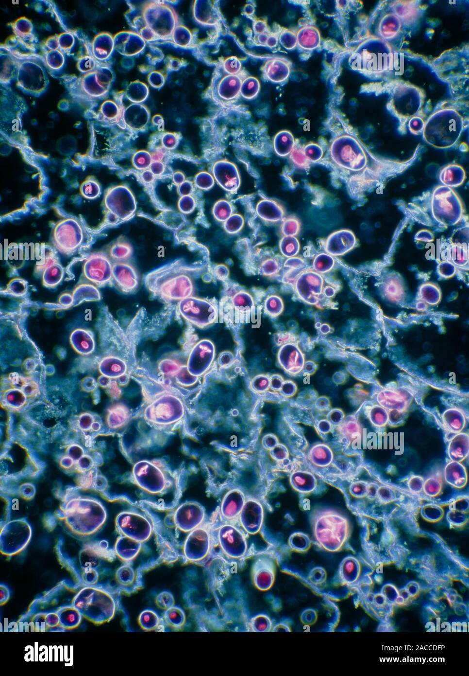 Light micrograph of a slice through a raw potato showing numerous ...