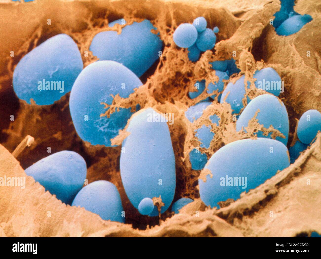 Potato Starch Coloured Scanning Electron Micrograph Of Starch Grains Mauve In The Cells Of A