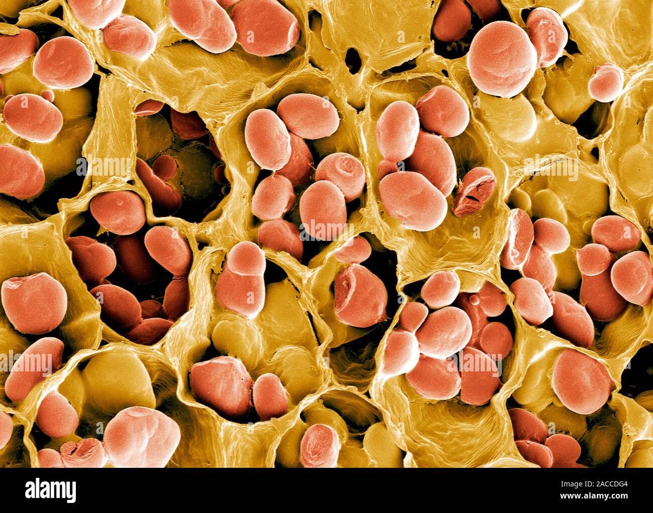 Starch grains. Coloured scanning electron micrograph (SEM) of starch ...