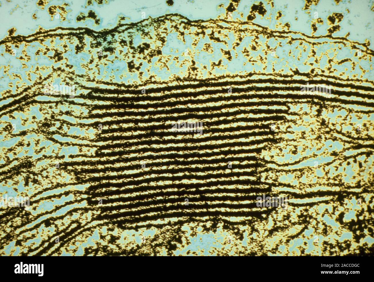 Chloroplast Electron Microscope