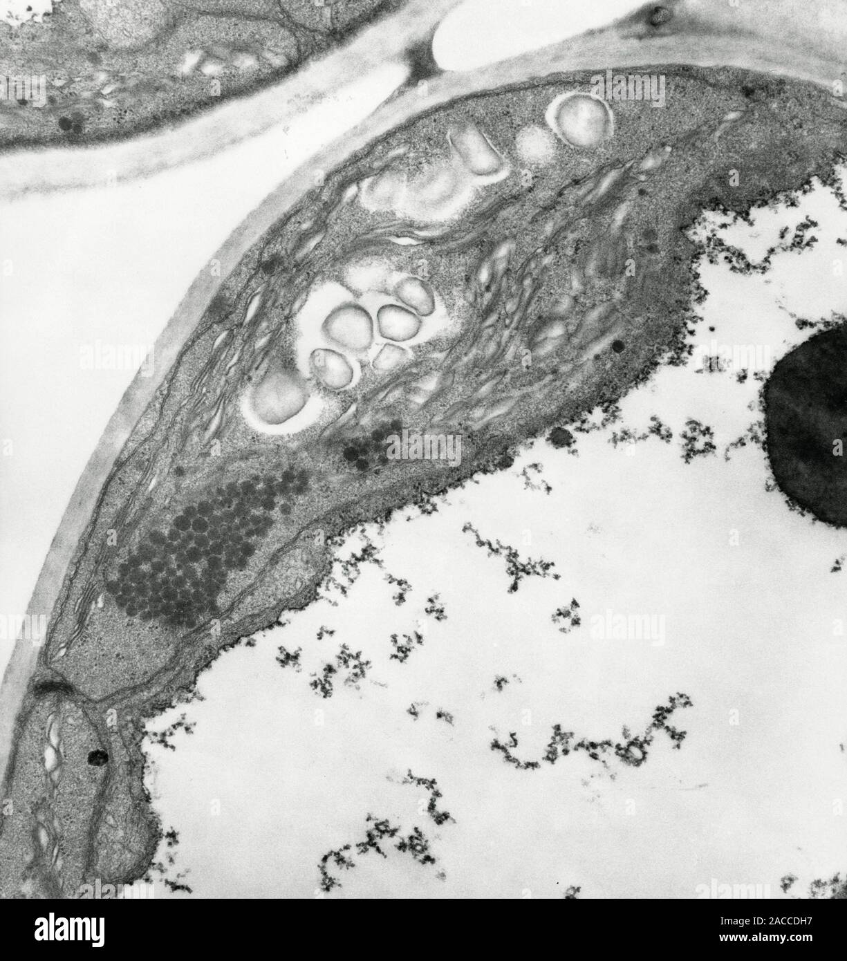 Chloroplast. Transmission electron micrograph (TEM) of a section ...