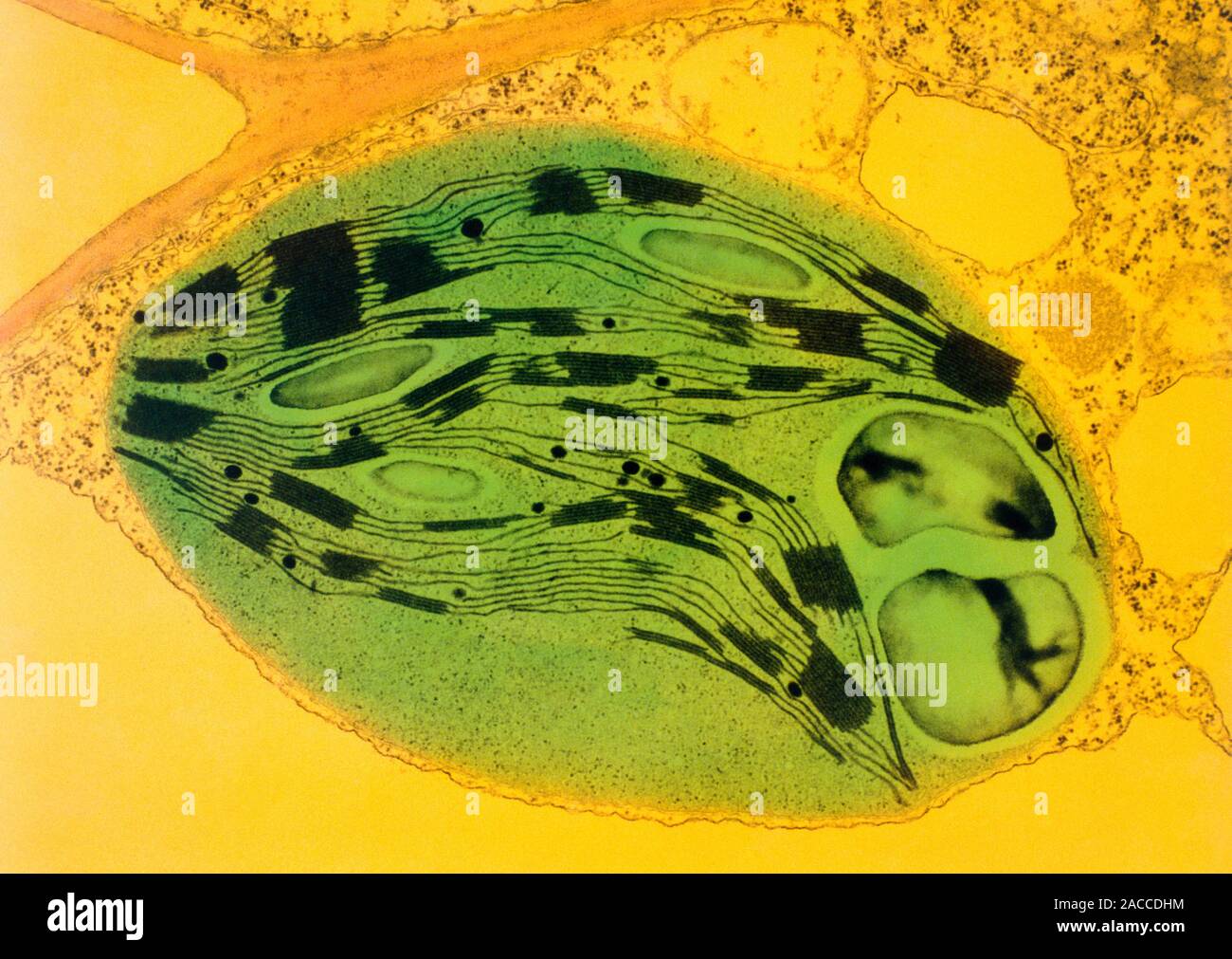Chloroplast, light micrograph. Chloroplasts are organelles found in ...