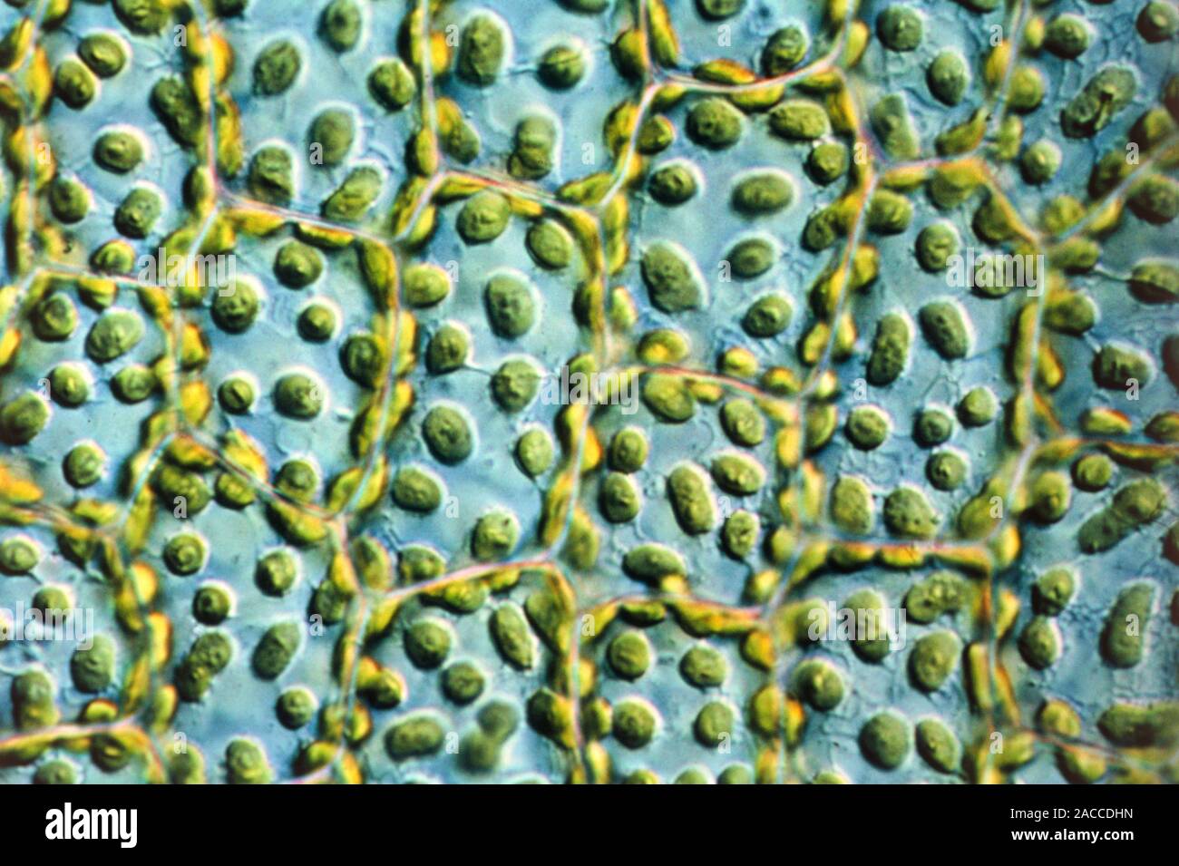 Chloroplasts. Light micrograph of moss cells, showing chloroplasts, a ...