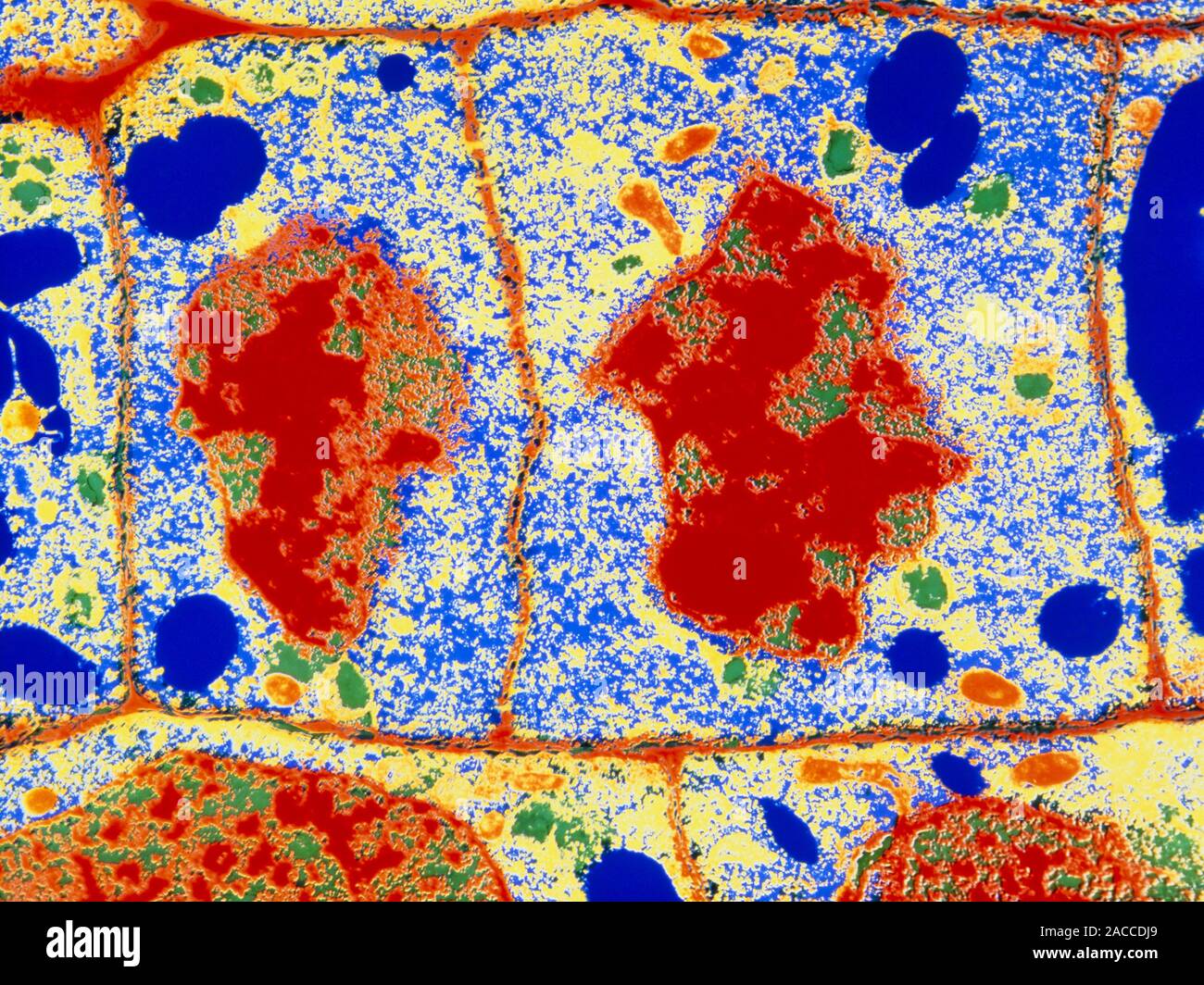 False-colour transmission electron micrograph of a late stage of cell ...