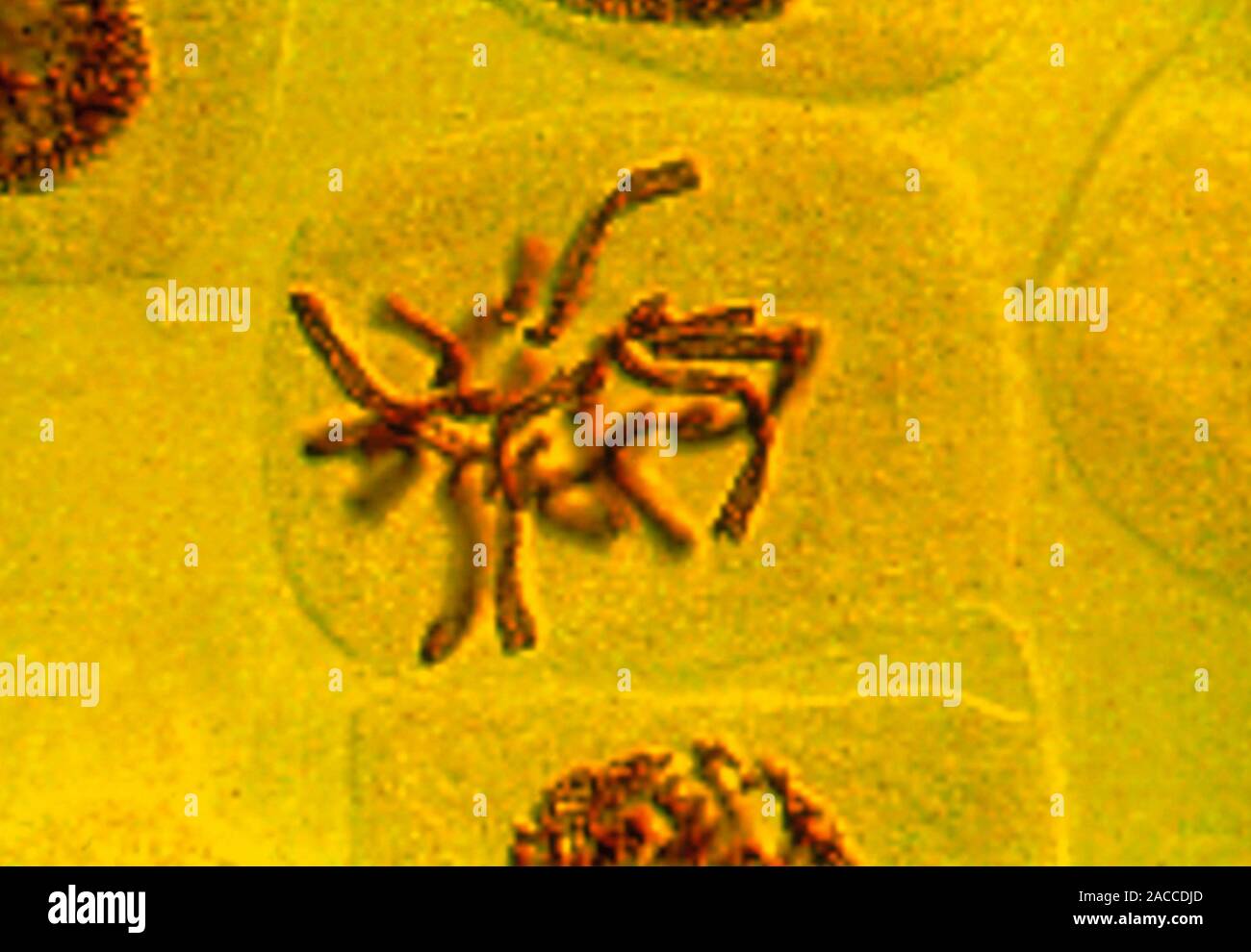 Prophase of cell mitosis. Image 2 of 6. Light micrograph of a bluebell ...
