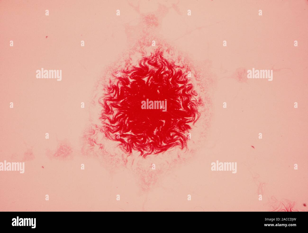 Light micrograph of a colony of Bacillus anthracis, after 9 hours ...