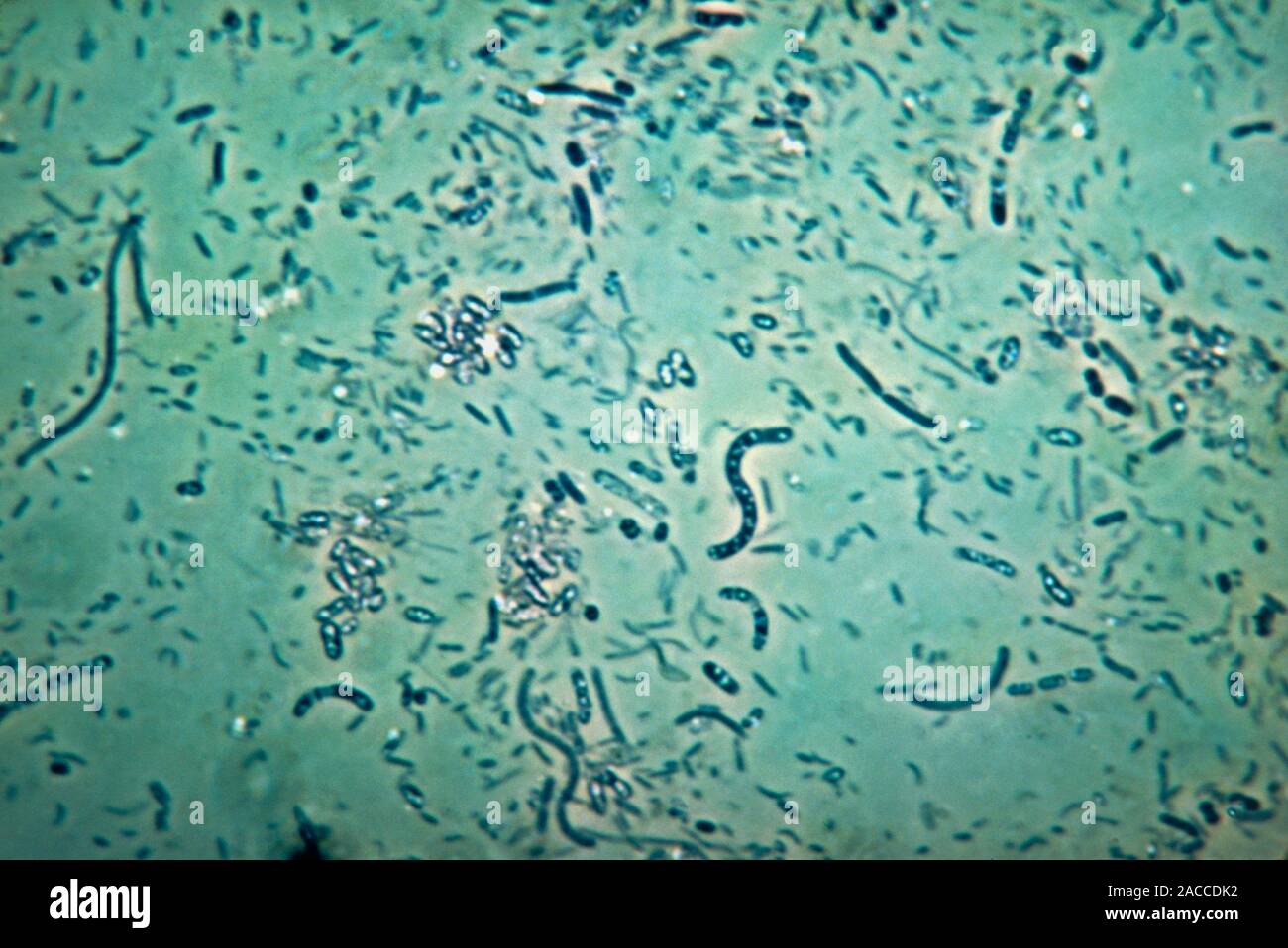 Polluted water. Light micrograph of a polluted water sample with many ...