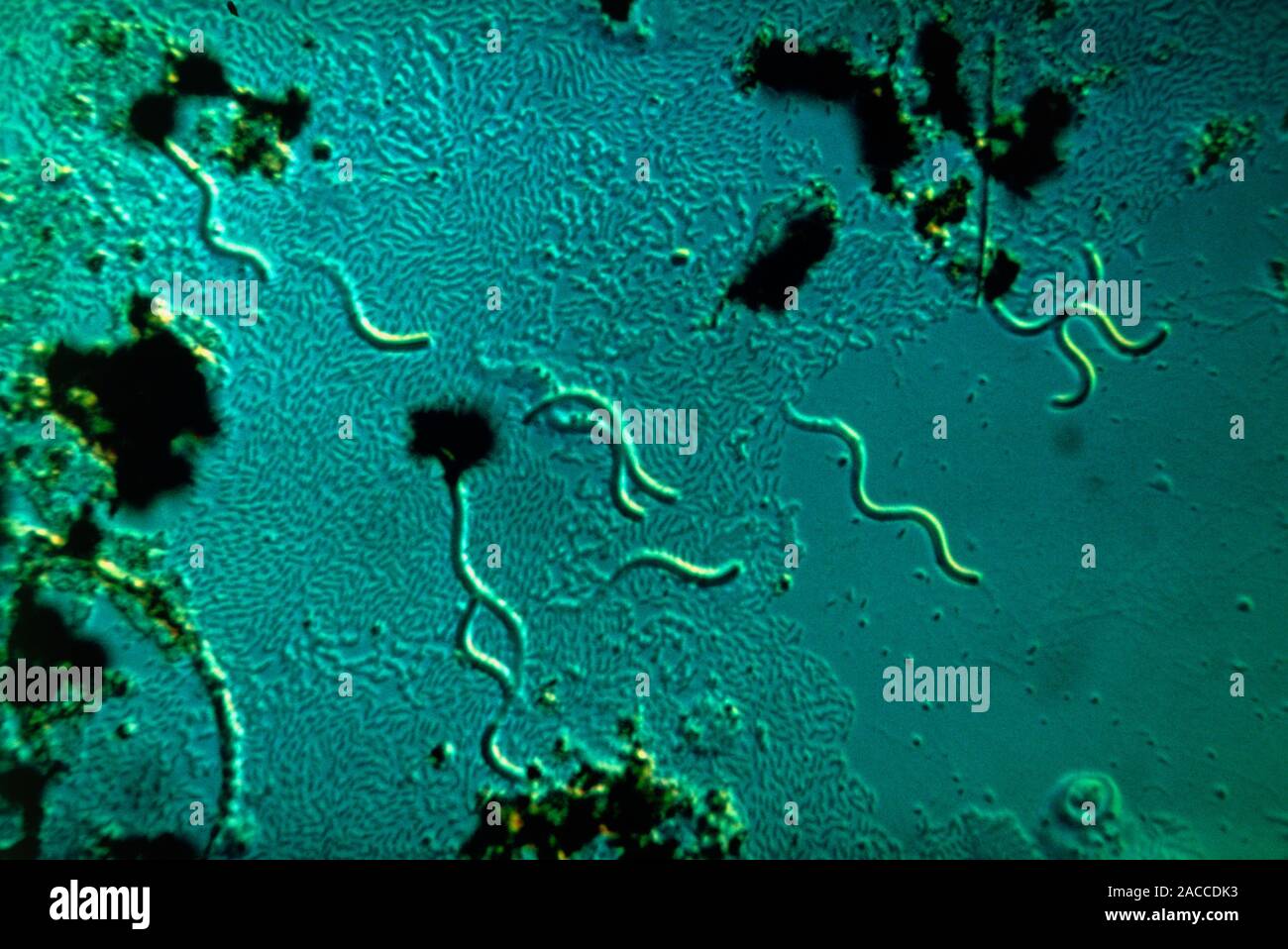 Spirochaetes. Light micrograph of several spiral- shaped spirochaetes ...