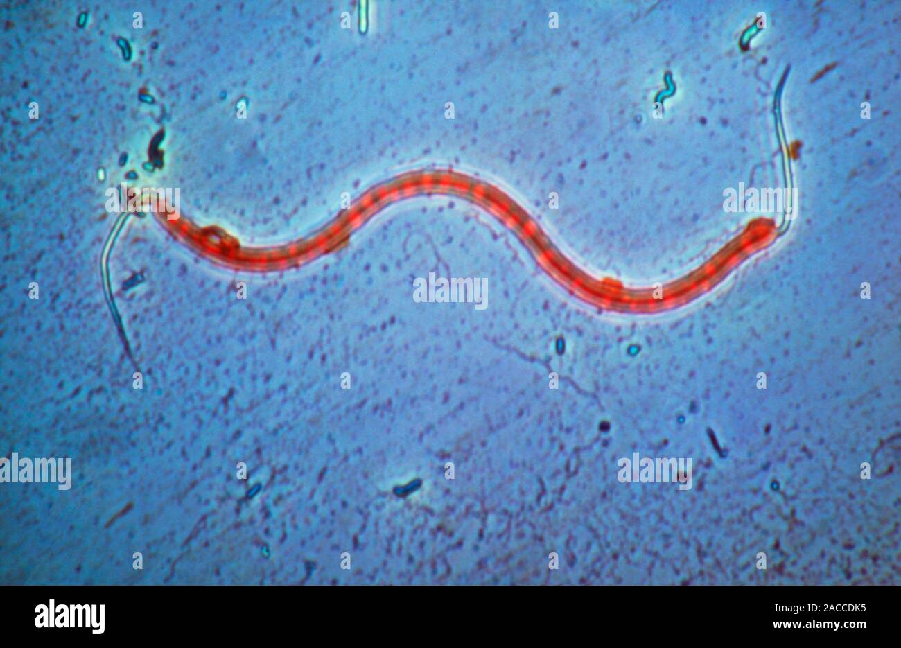 Spirillum volutans. Light micrograph of a single Spirillum volutans ...