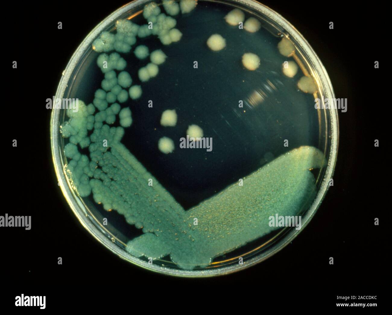 Petridish culture of the pathogenic bacteria Pseudomonas aeruginosa ...