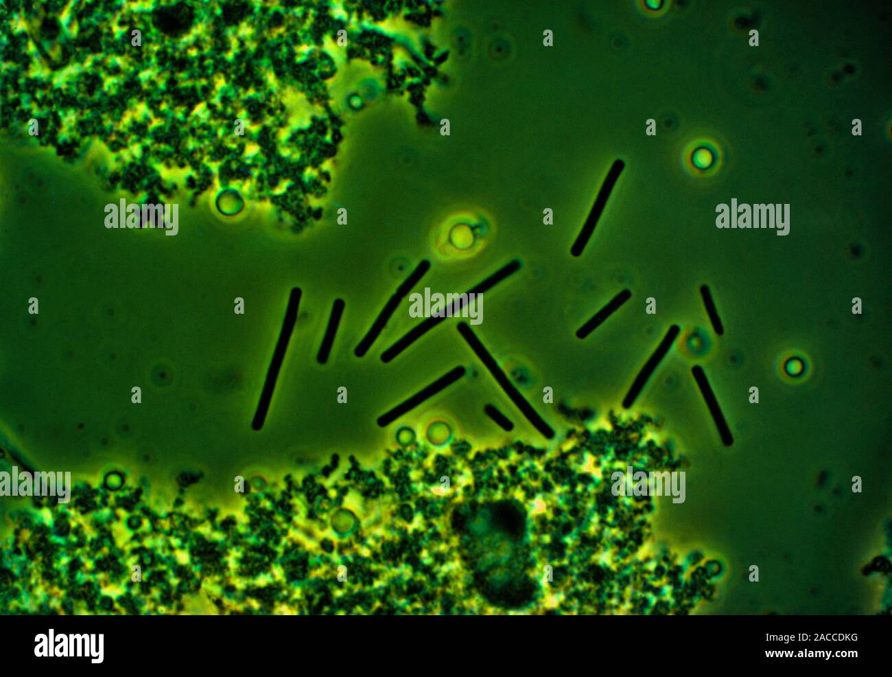 Light micrograph (phase contrast) of the bacteria Lactobacillus ...