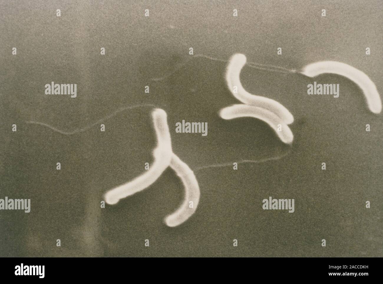 Scanning electron micrograph (SEM) of the comma- shaped bacterium ...