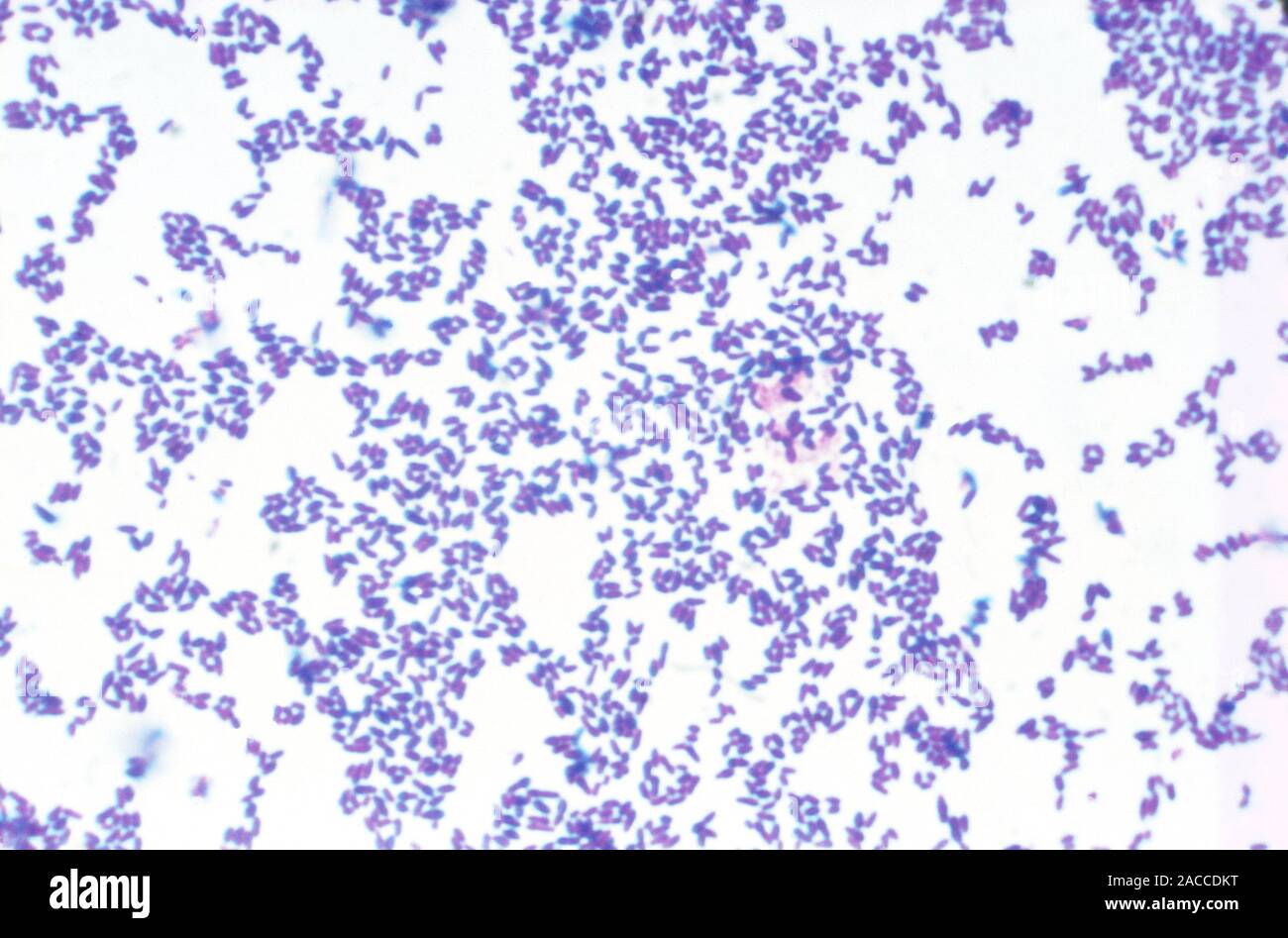 Light micrograph of Corynebacterium diphtheria, a medium sized rod ...