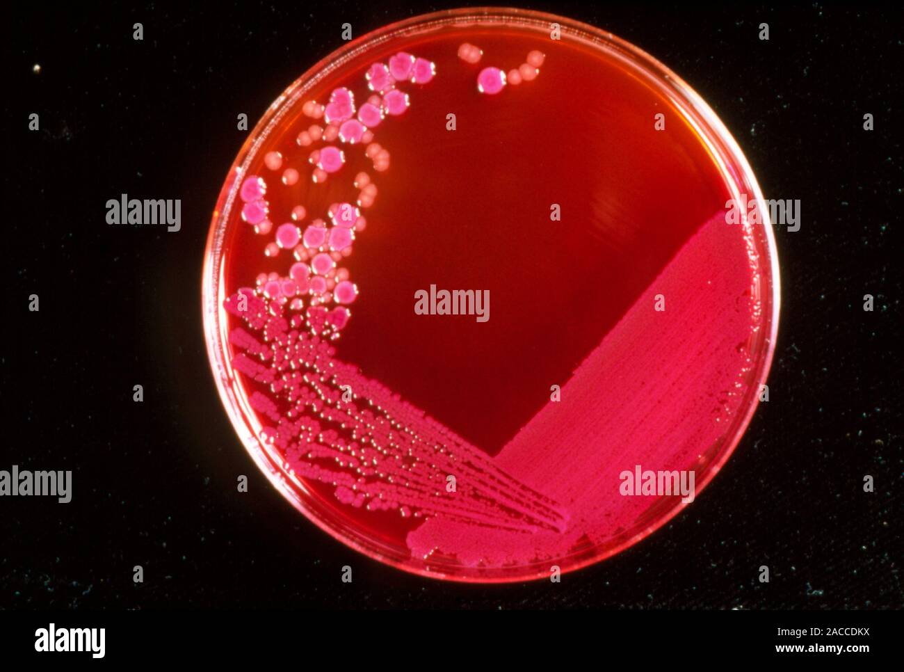 Photograph of petri dish cultures growing mixed colonies of Escherichia ...