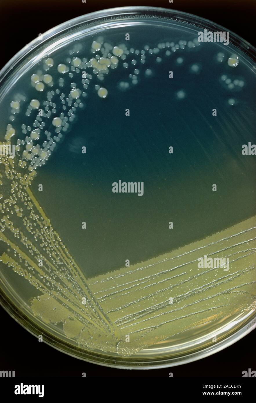 Photograph of petri dish cultures growing mixed colonies of the ...