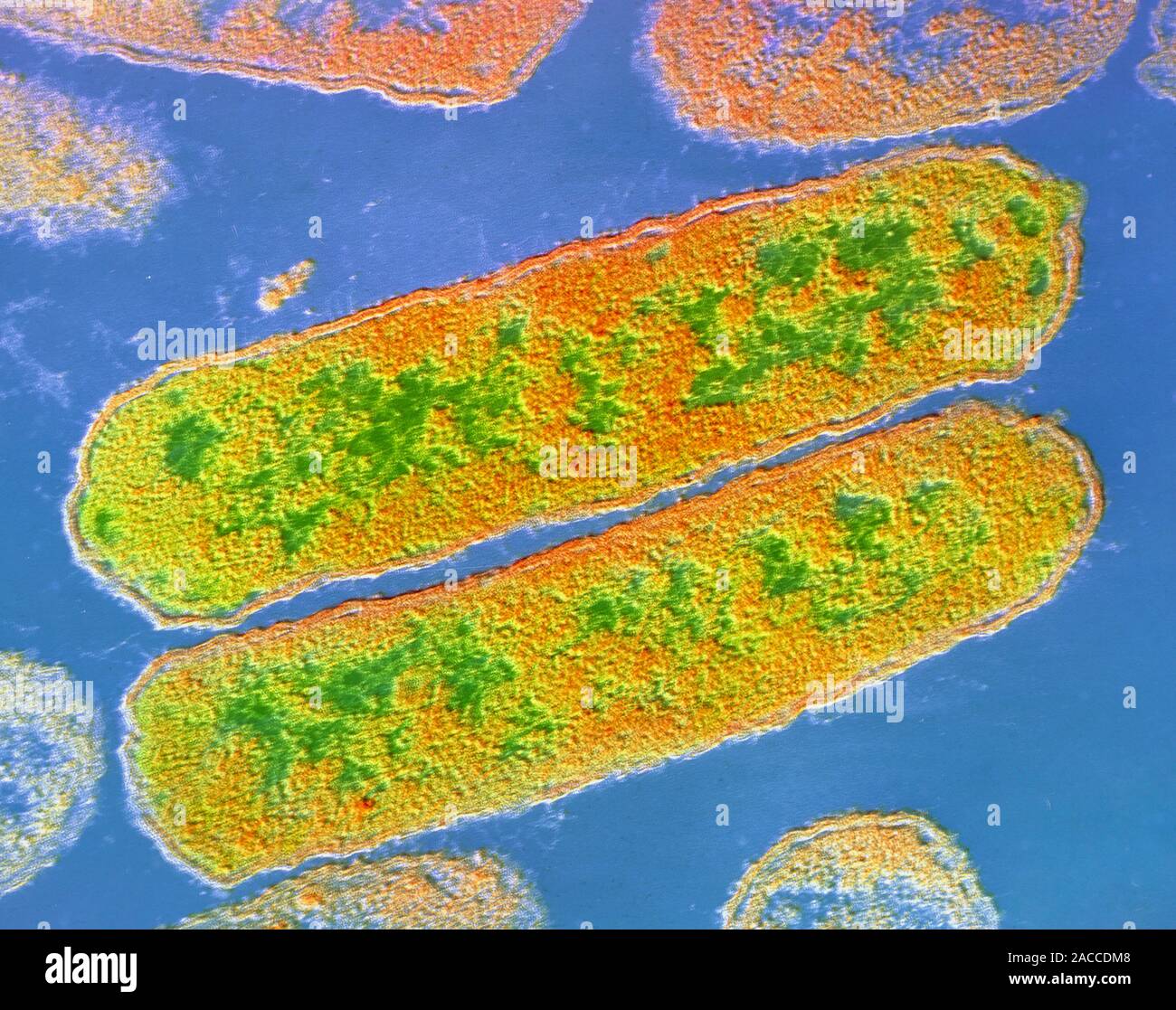 False-colour transmission electron micrograph (SEM) of Haemophilus ...