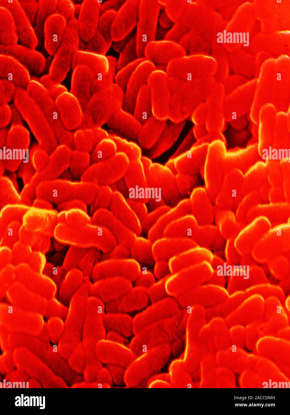 False-colour scanning electron micrograph, SEM, of the rodlike bacteria ...