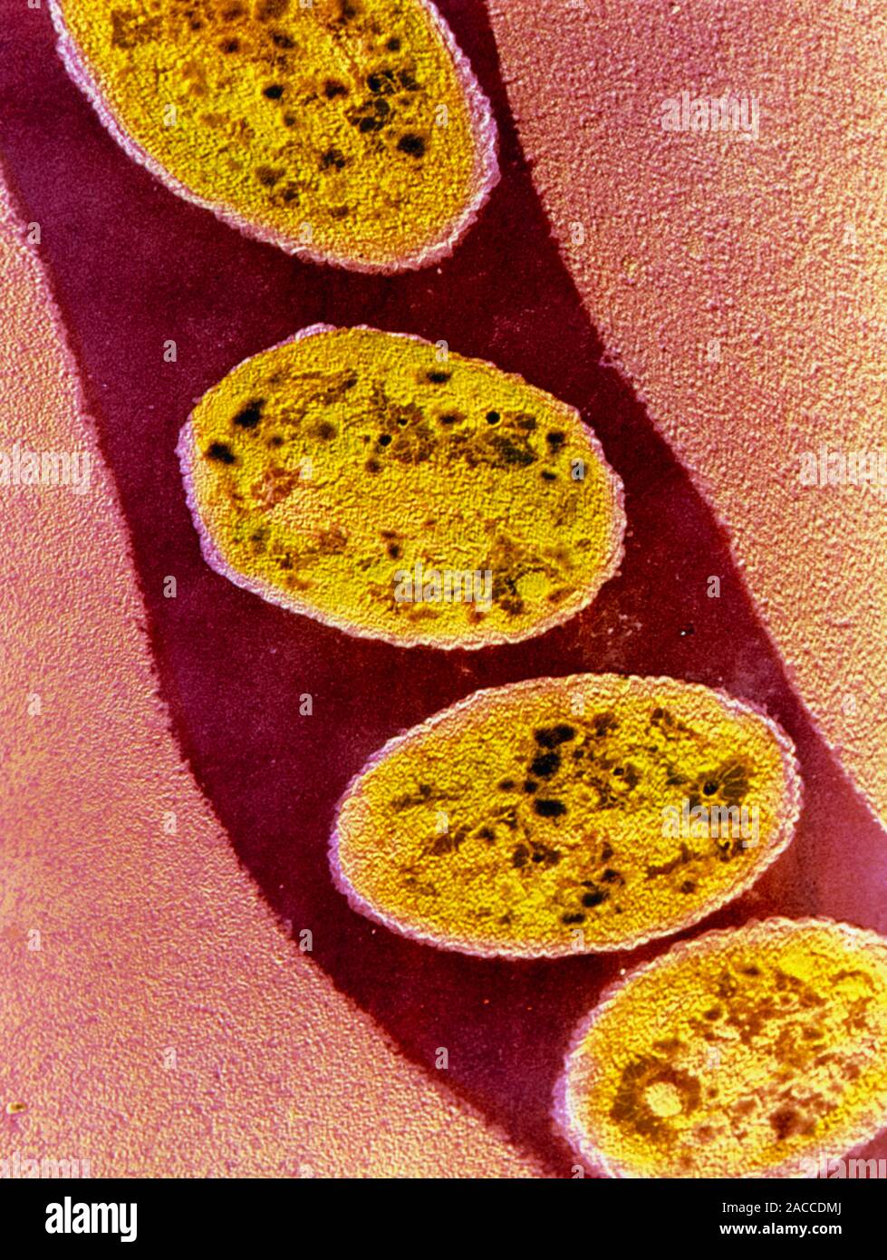 False colour transmission electron micrograph of Borrelia sp (gram ...