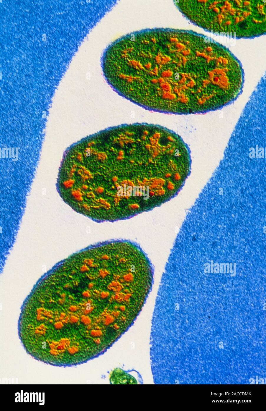 False colour transmission electron micrograph of Borrelia sp (gram ...
