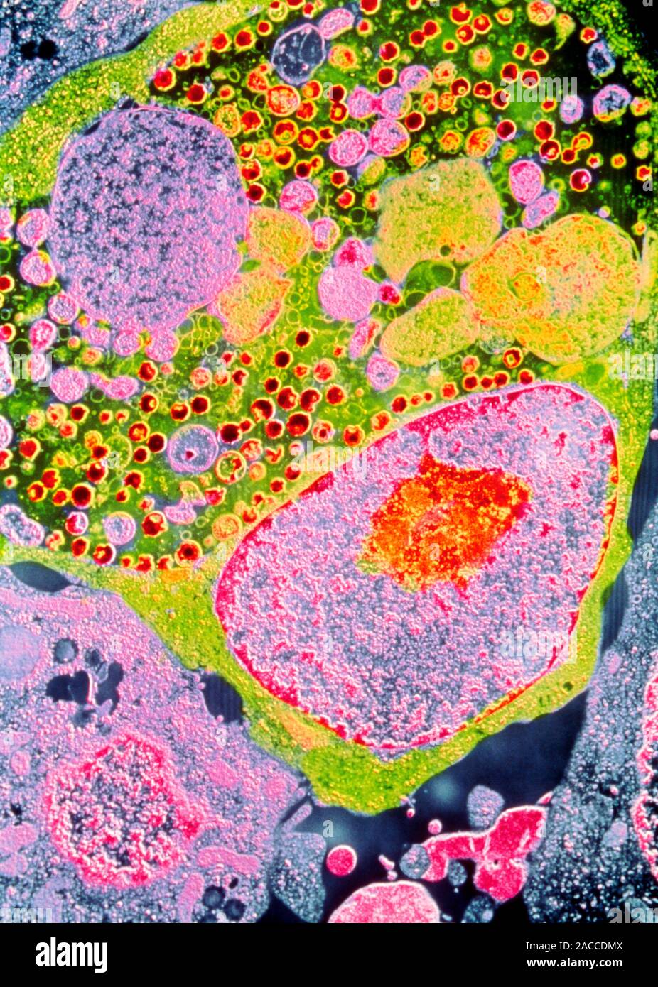 False-colour transmission electron micrograph of spherical bacteria ...