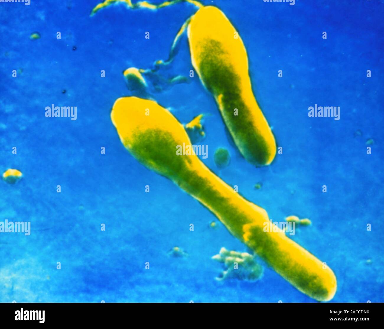 Clostridium Tetani Electron Micrograph