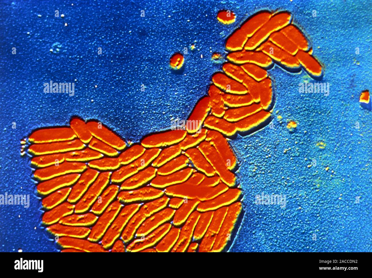 Erysipelothrix rhusiopathiae. Coloured transmission electron micrograph ...