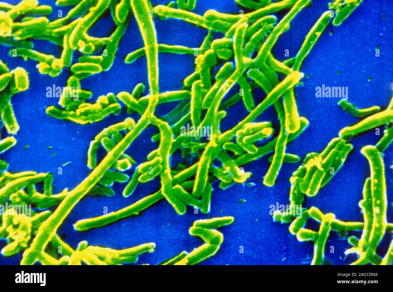 False-colour scanning electron micrograph (SEM) of Corynebacterium ...