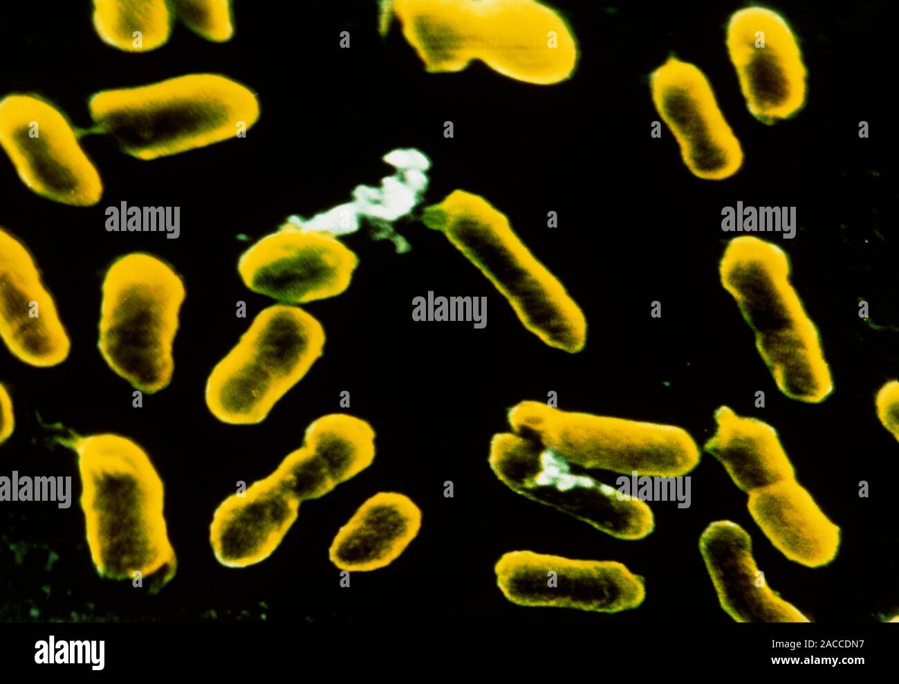 Proteus bacteria. False-colour scanning electron micrograph (SEM) of a ... Proteus bacteria. False-colour scanning electron micrograph (SEM) of a ...