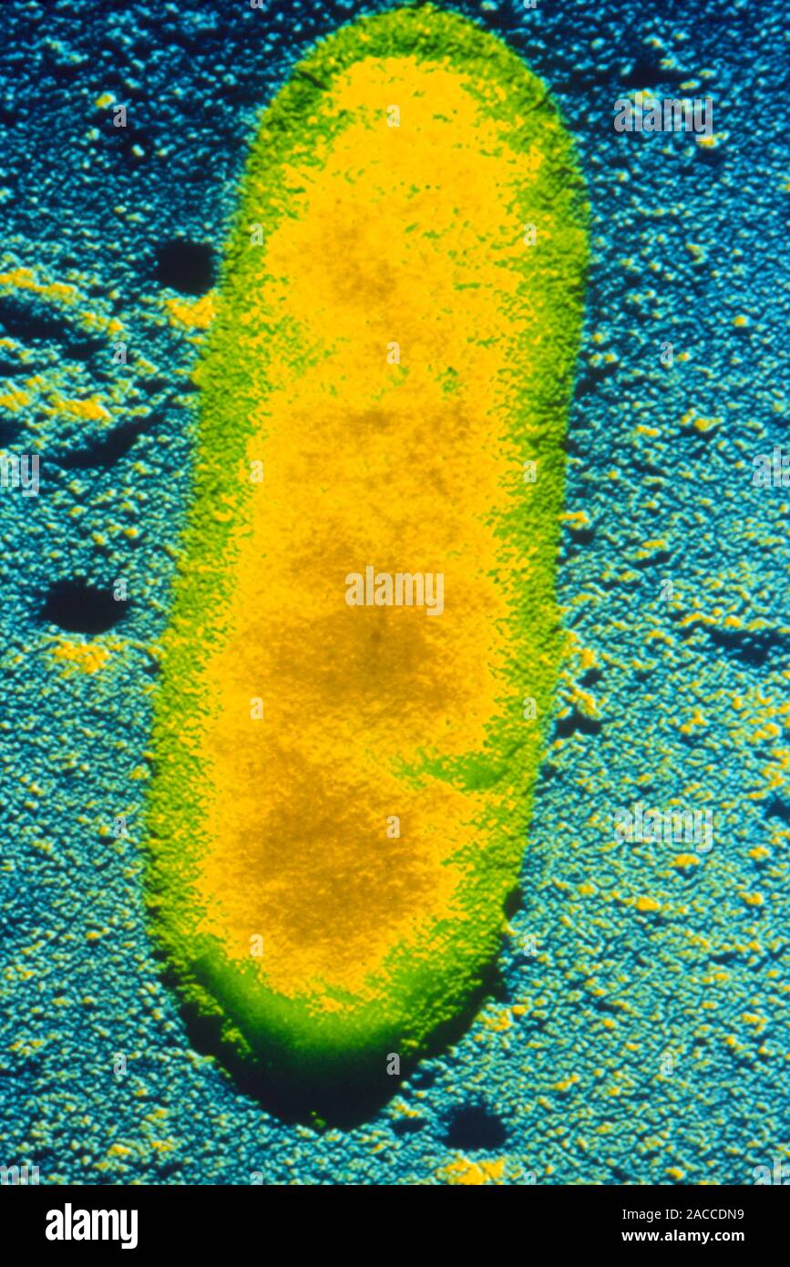 False-colour shadow transmission electron micrograph (TEM) of an ...