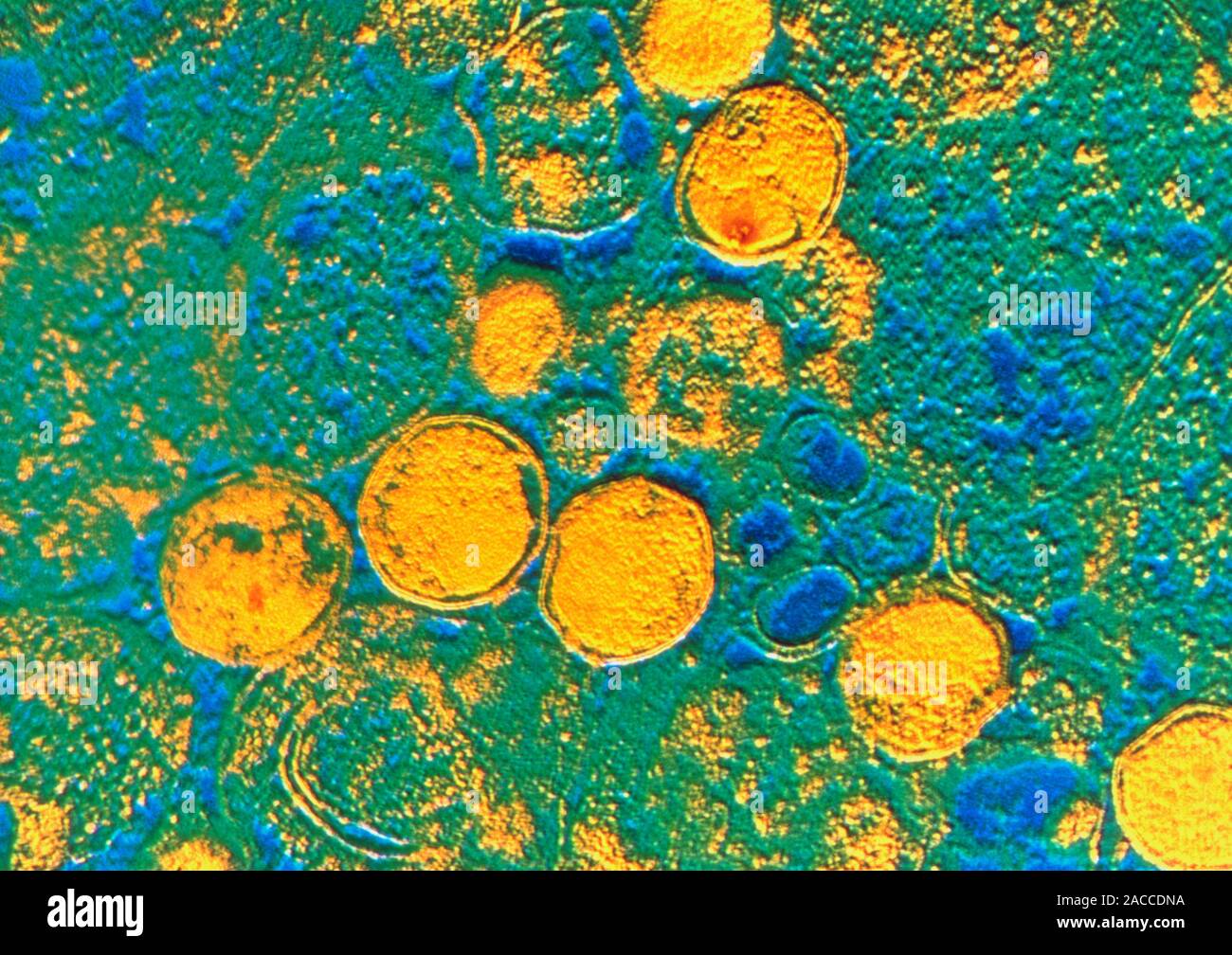 False-colour transmission electron micrograph (TEM) of a no. of ...