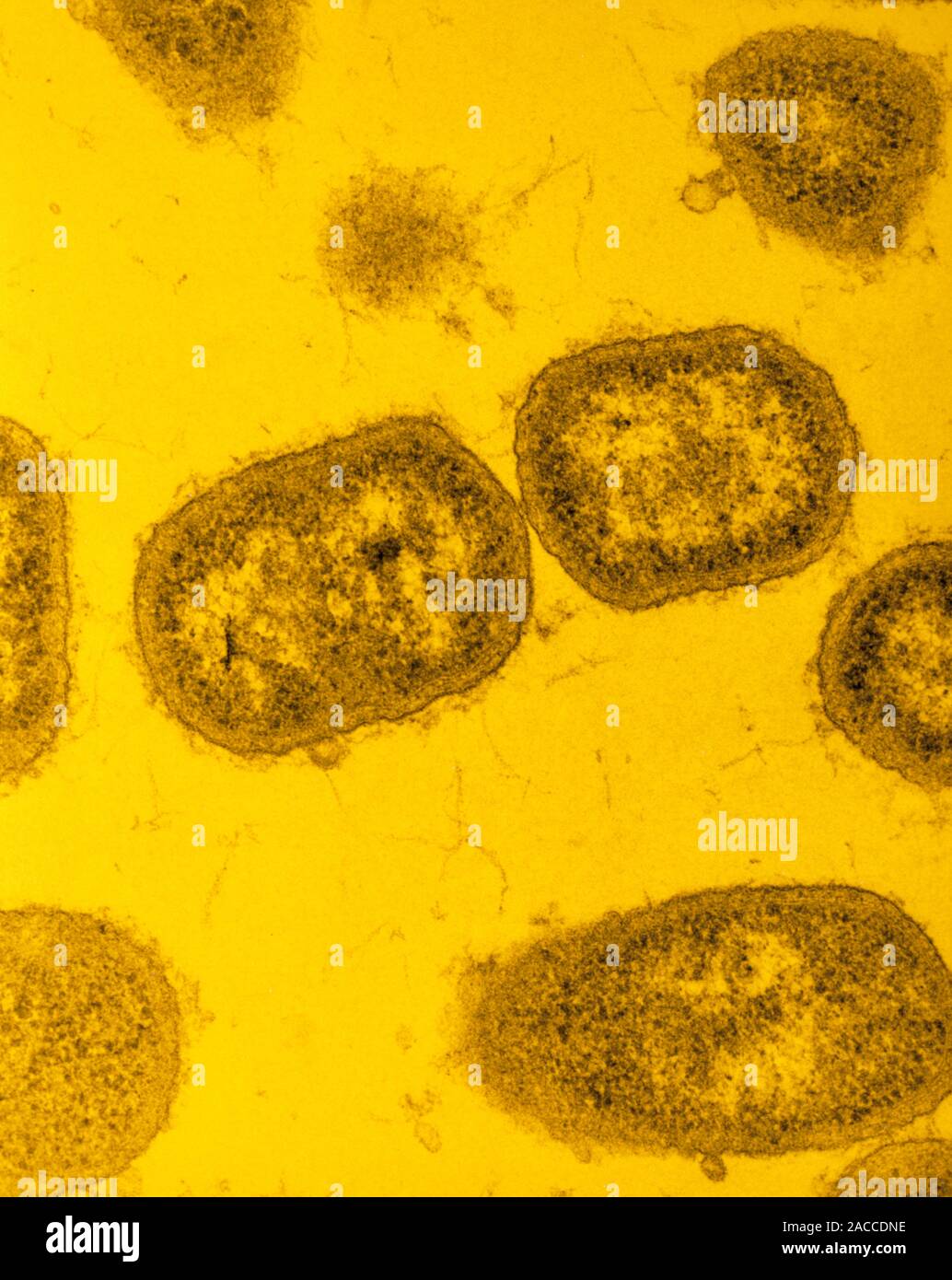 False colour transmission electron micrograph (TEM) of colony of ...