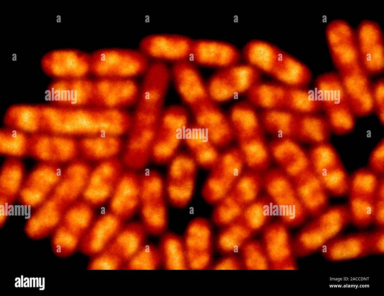 Typhoid bacteria. Acridine orange fluorescent light micrograph of ...