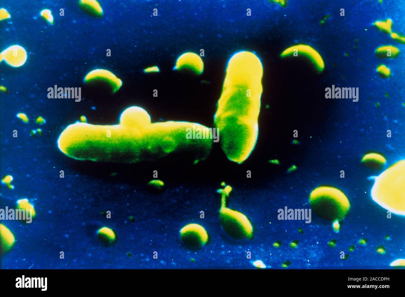 False colour scanning electron micrograph (SEM) of a small colony of ...