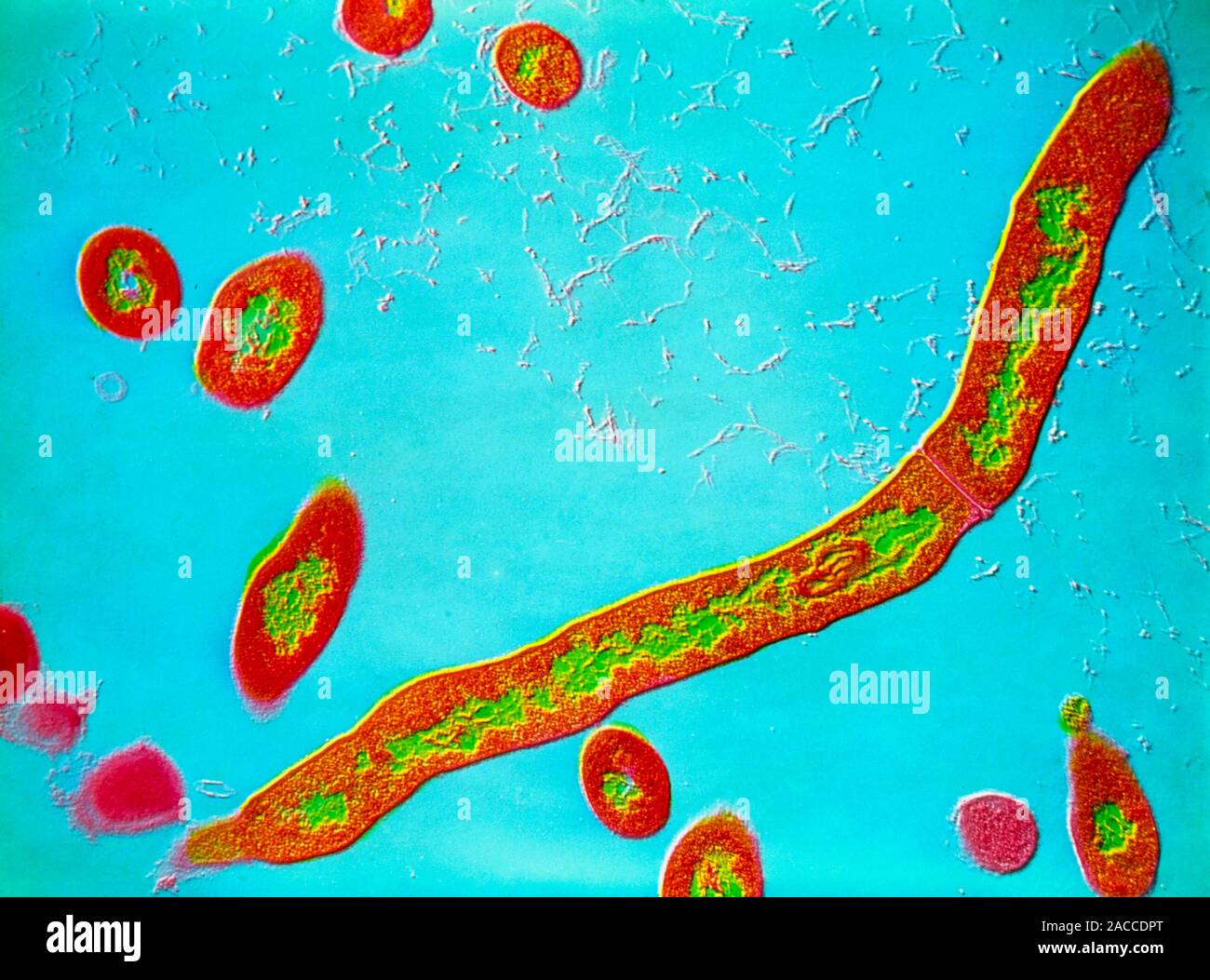 False-colour transmission electron micrograph (TEM) of a colony of ...