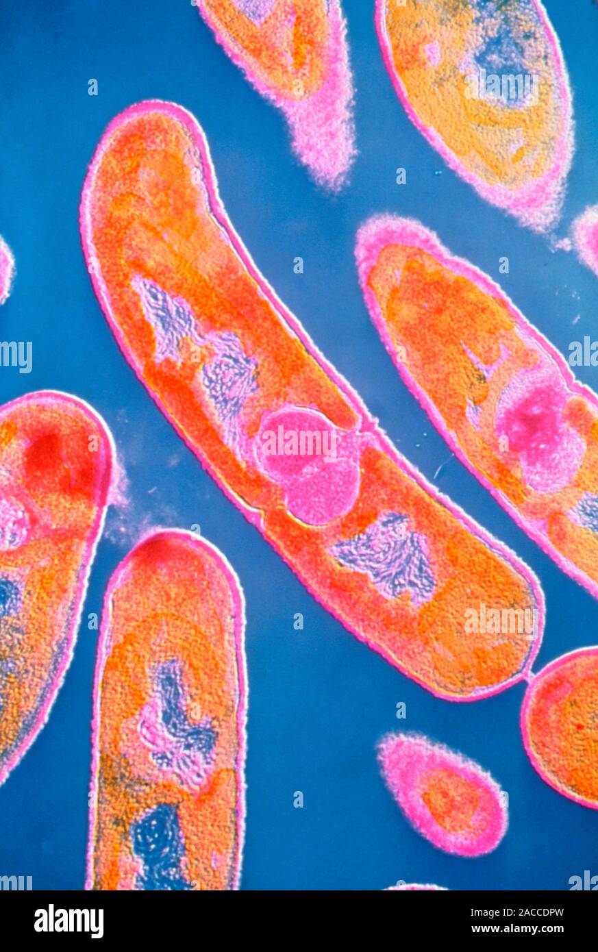 False colour transmission electron micrograph (TEM) of a colony of ...