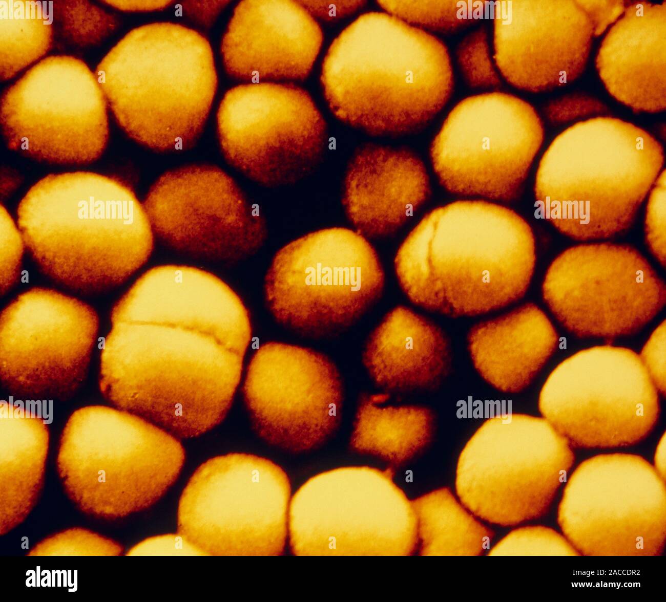 False colour scanning electron micrograph (SEM) of a colony of ...