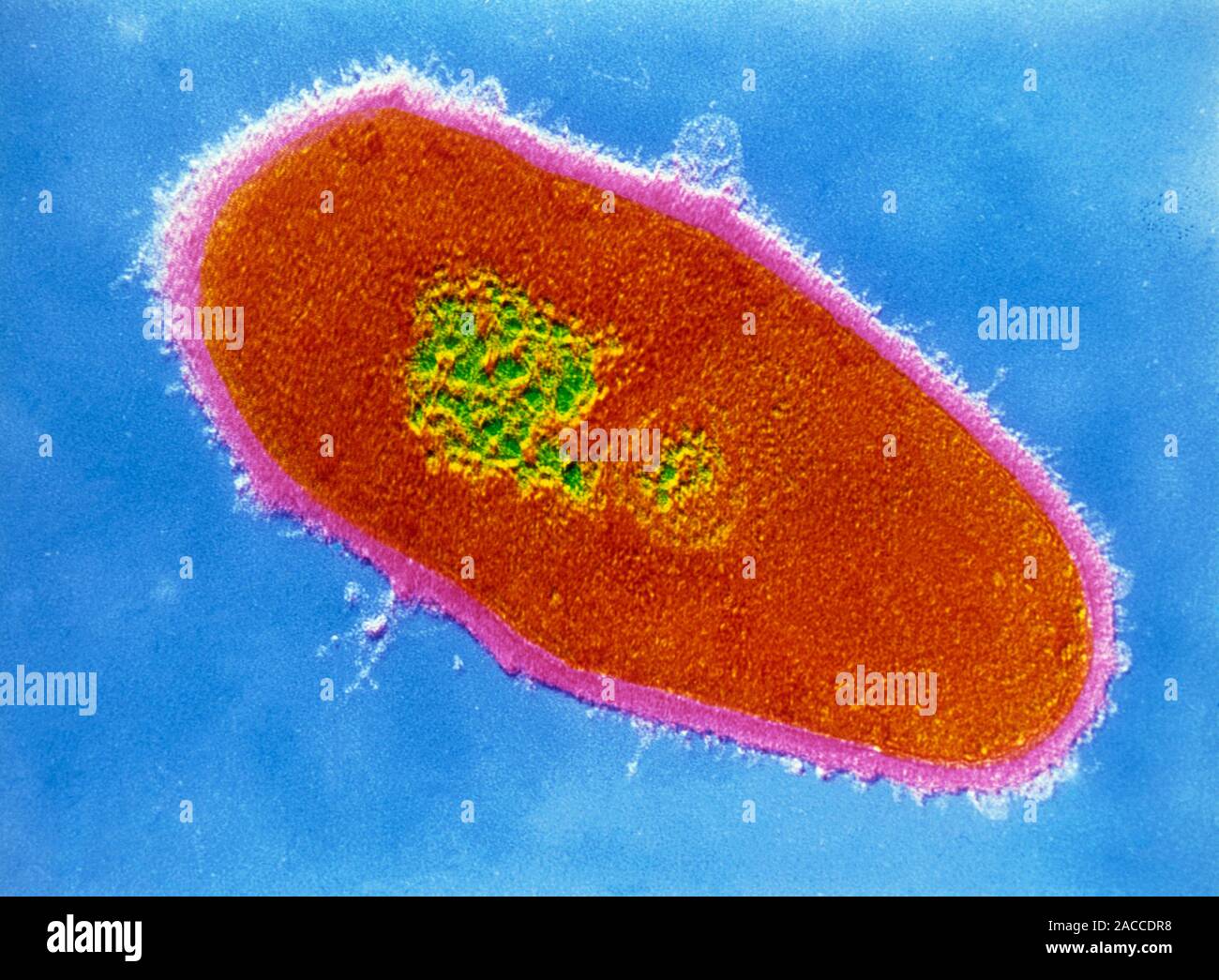 False Colour Transmission Electron Micrograph Tem Of Corynebacterium Minutissimum Showing A