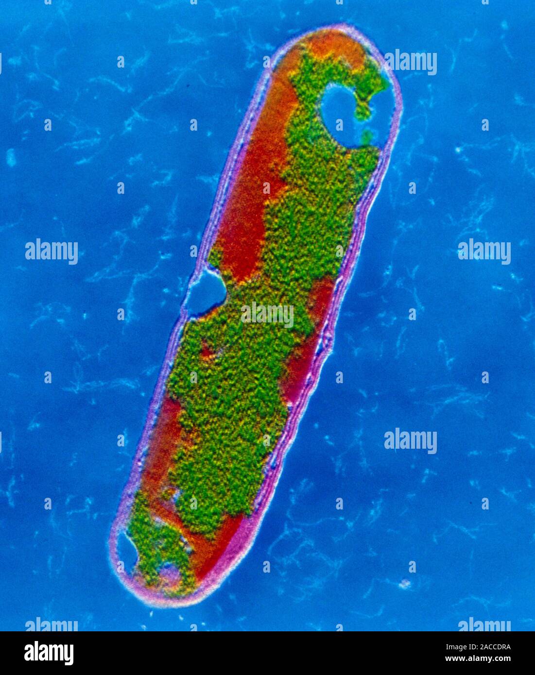 False Colour Transmission Electron Micrograph Tem Of The Bacterium Clostridium Tetani A Gram