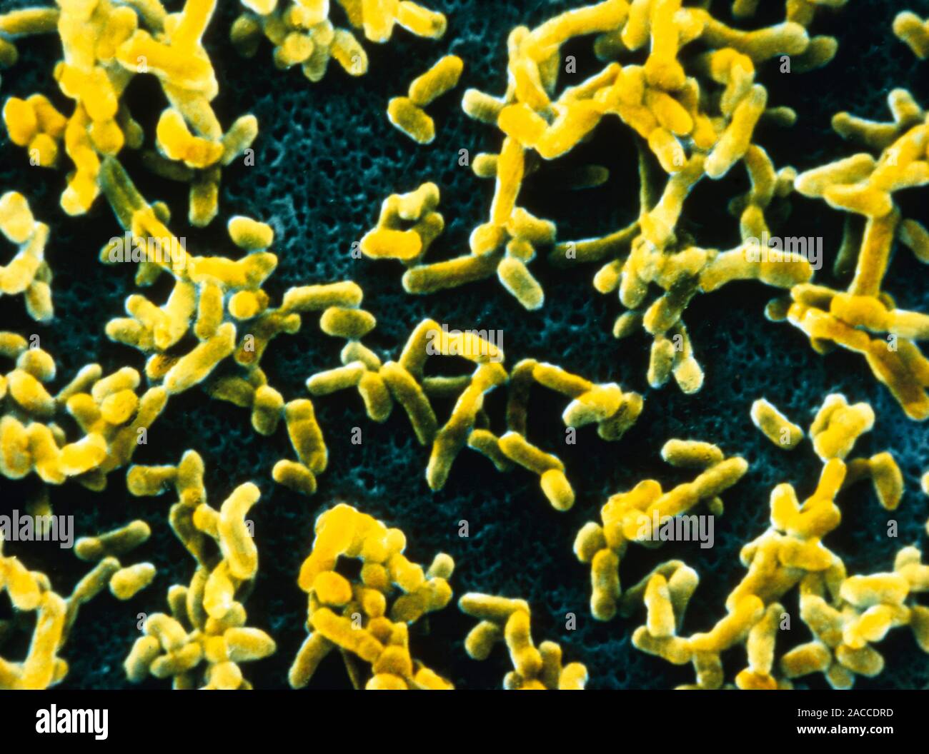 False colour scanning electron micrograph (SEM) of a colony of Yersinia ...