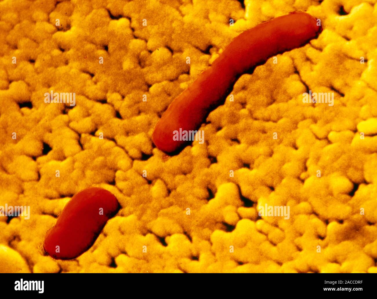 False colour scanning electron micrograph (SEM) of Haemophilus ...