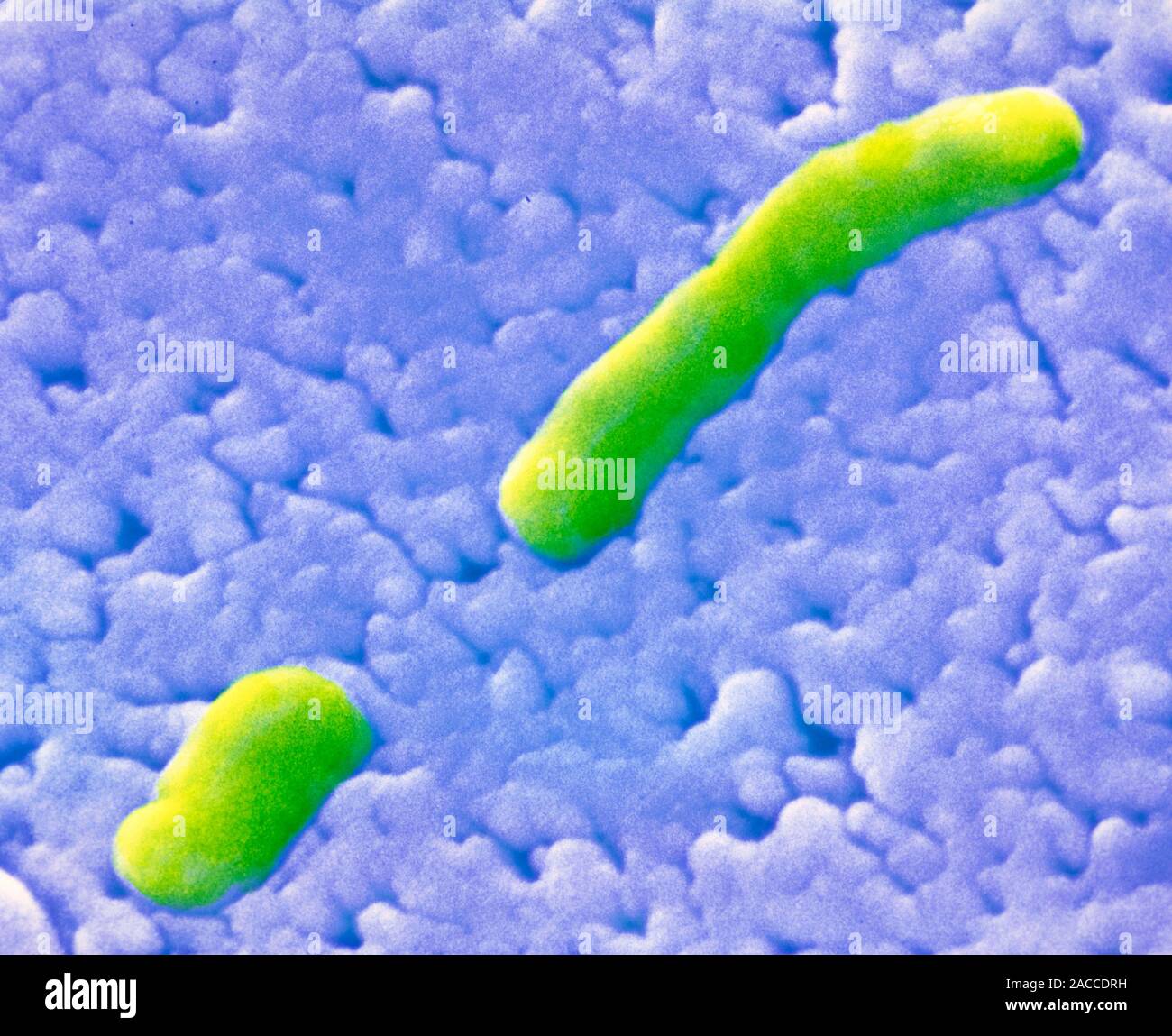 False-colour scanning electron micrograph (SEM) of Haemophilus ...