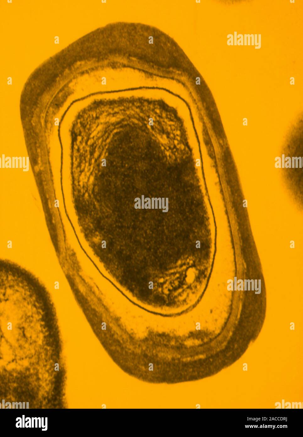 False Colour Transmission Electron Micrograph Of A Thin Section Through An Endospore Of Bacillus