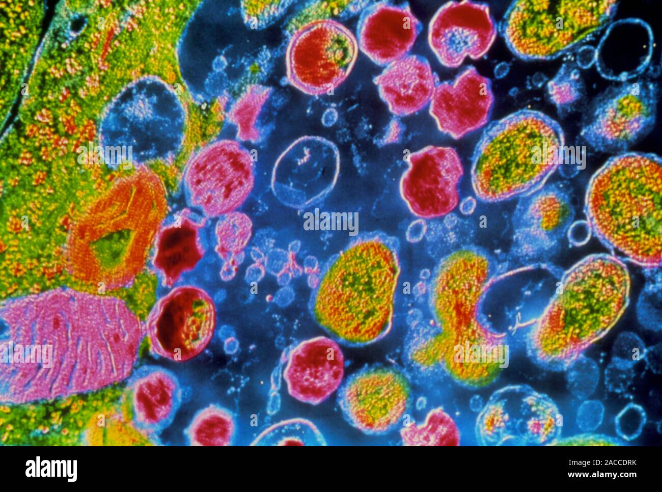 False-colour transmission electron micrograph (TEM) of Chlamydia sp., a ...
