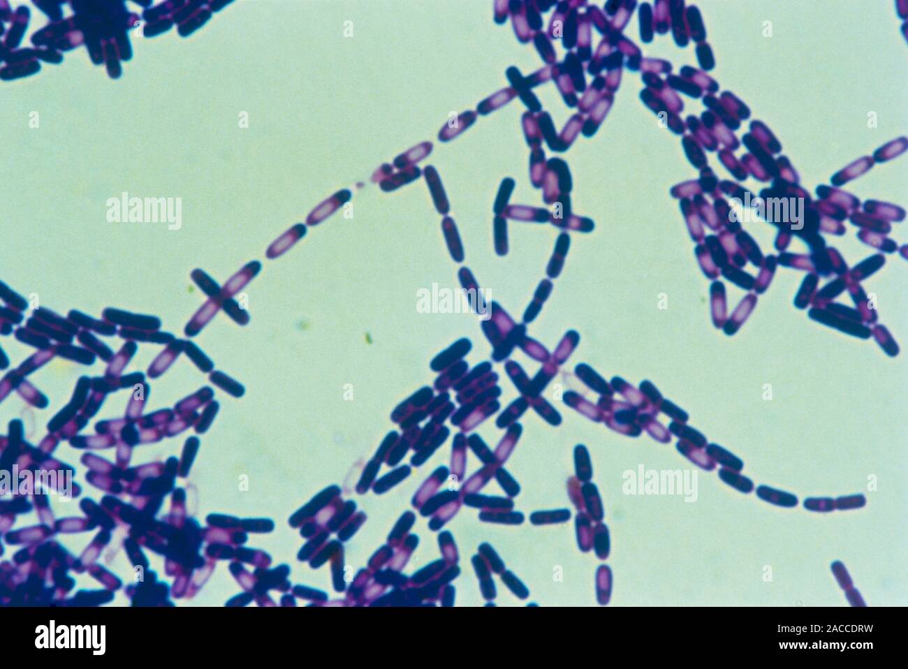 Light micrograph of a colony of Bacillus subtilis (the Hay Bacillus), a ...