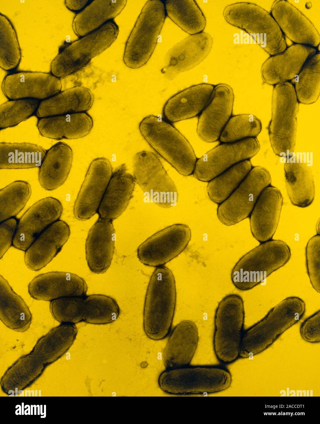 False colour transmission electron micrograph of a field of whooping ...