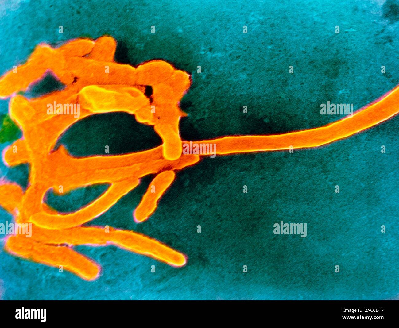 False colour scanning electron electron micrograph (SEM) of ...
